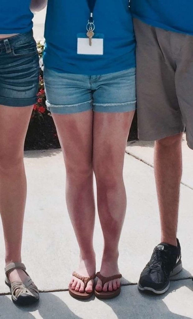 Los peores bronceados - Kebuena